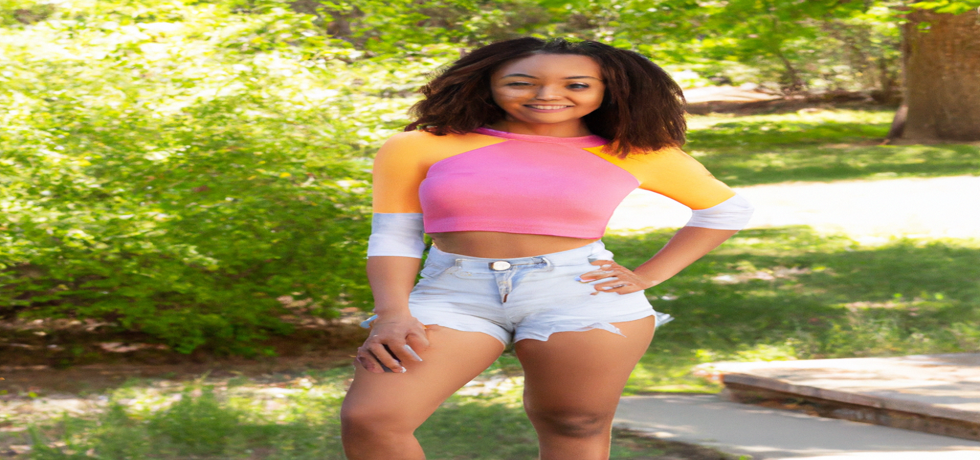 Celebrating Differences Ectodermal Dysplasia Syndactyly Syndrome Awareness Theskinartistry